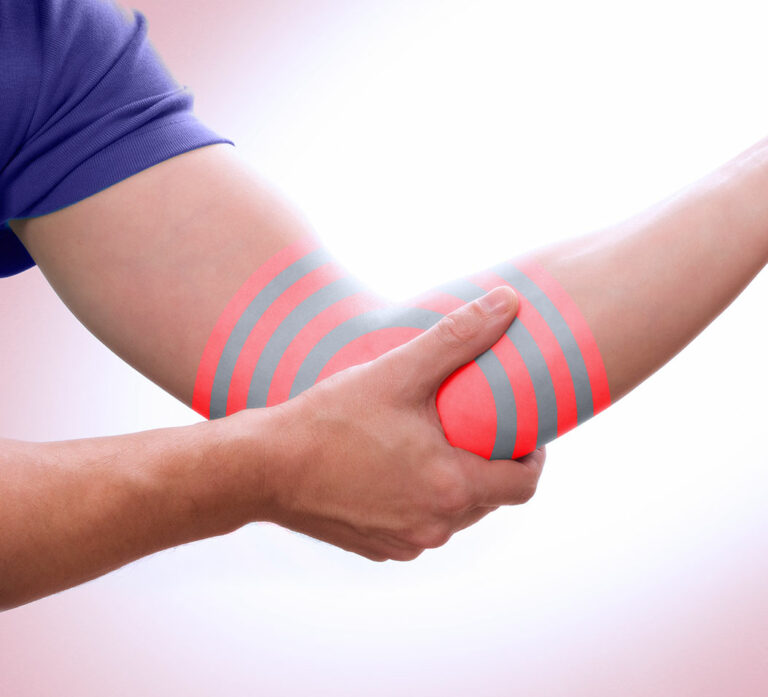 Ellenbogen – Gemeinschaftspraxis Dr. med. C. Conrad und Dr. med. M ...